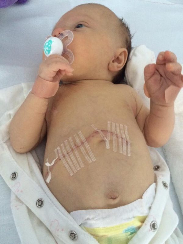 This is part of who we are - Childrens Liver Disease Foundation