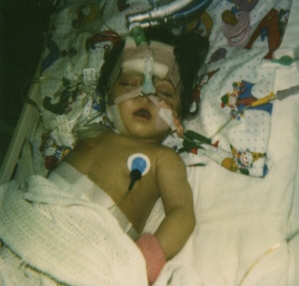 I’ve lived a healthy 30 years since then - Childrens Liver Disease ...